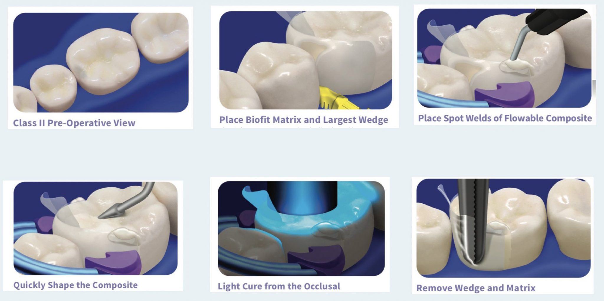 Bioclear® Method - Whitemarsh Family Dentistry